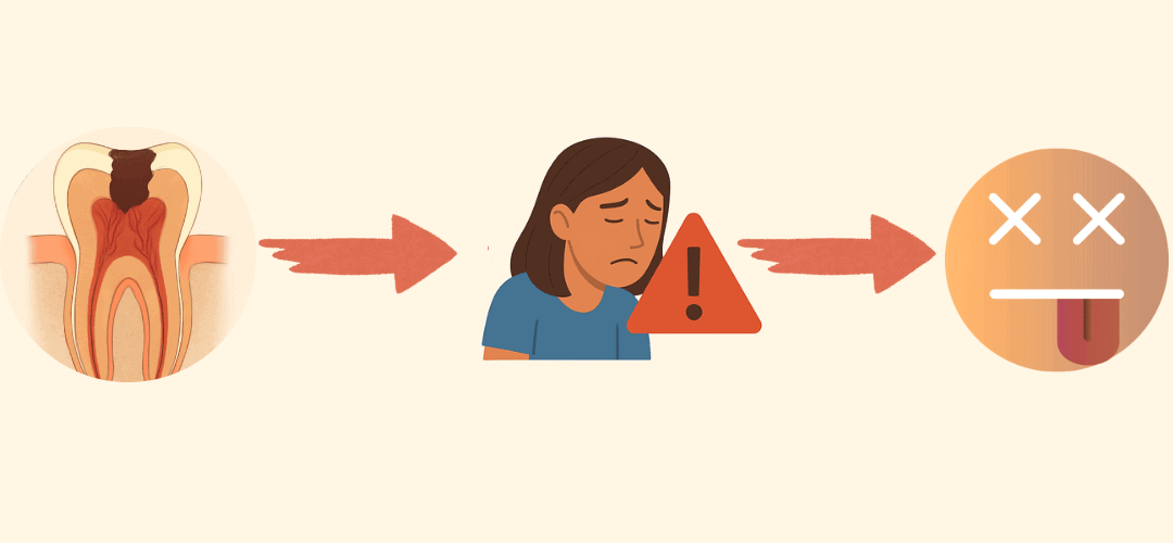 Tooth Abscess Stages: Early Signs to Dangerous Complications - Hop Dental